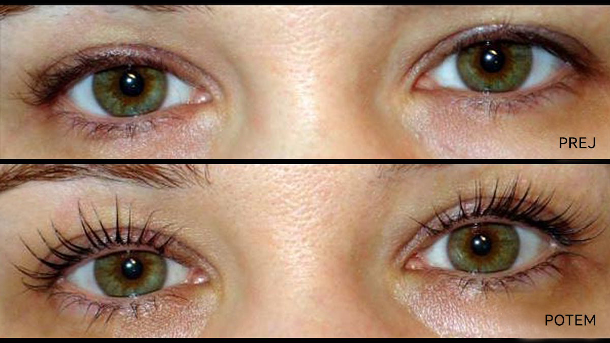 yumi-lashes-metoda-za-podalj-anje-trepalnic-center-zdravljenja